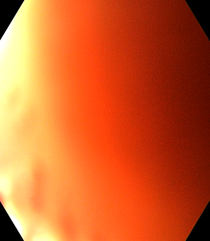 gastro.sistemadeconsultas.com - /Estudios/4290/20220302/