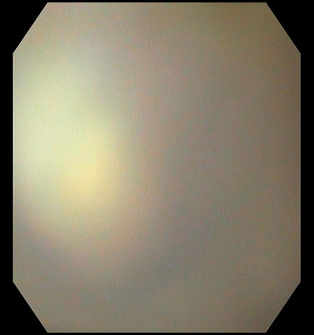 gastro.sistemadeconsultas.com - /Estudios/6377/20221216/