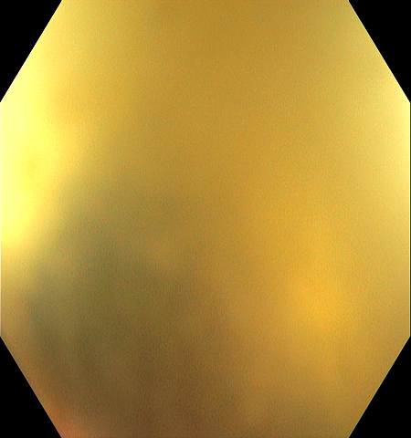 gastro.sistemadeconsultas.com - /Estudios/6959/20230315/